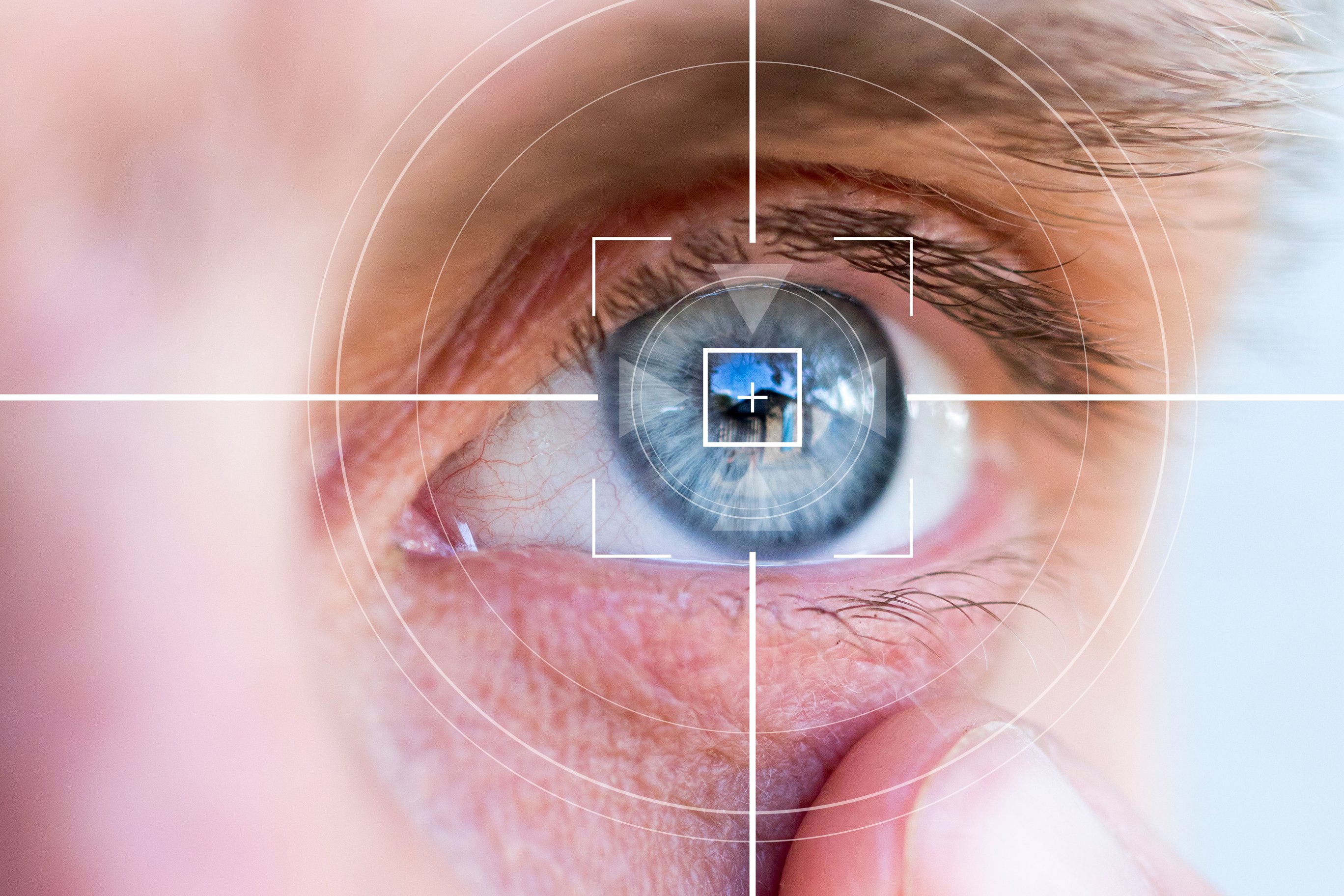 What is Astigmatism?